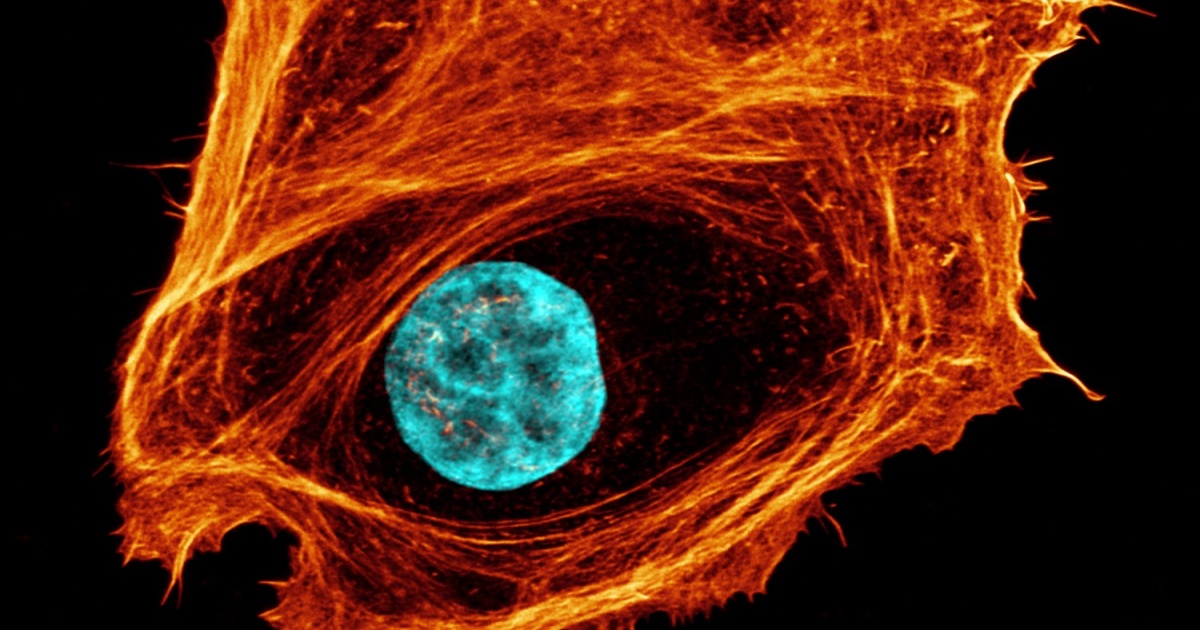 Die Physik des Krebses • pro-physik.de - Das Physikportal